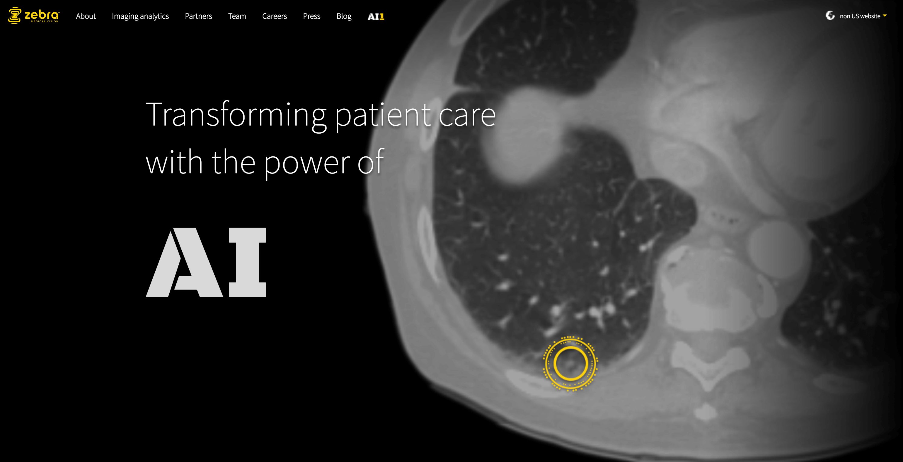 Zebra Medical Vision / 『テクノロジーを活用し、一つでも救える命を』AIを活用し医療用画像を分析し、異常を検出する技術 ...